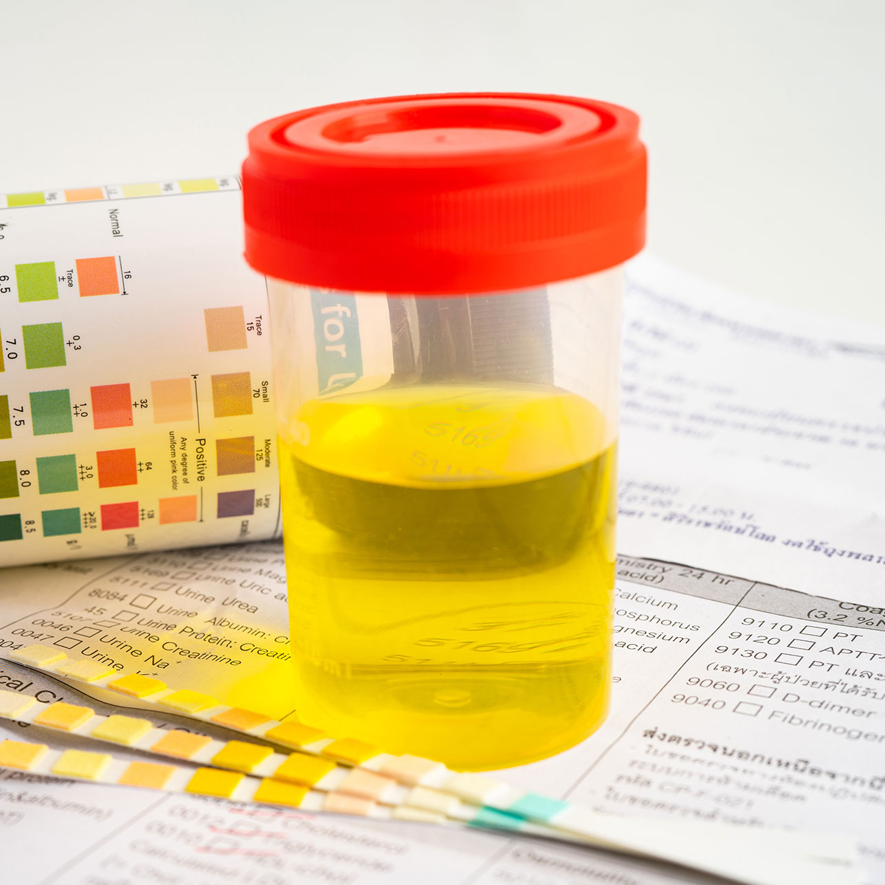 Urine Drug Testing- 12 Panel - CorePlus